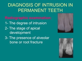 Management of severely intruded central incisor 1 | PPT
