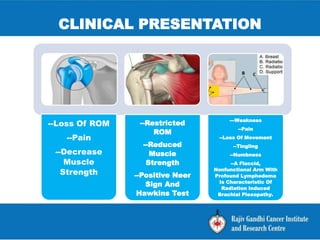 Management of shoulder dysfunction in breast cancer | PPT