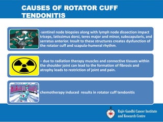 Management of shoulder dysfunction in breast cancer | PPTX
