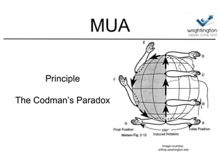 Management of shoulder stiffness | PPTX