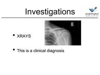 Management of shoulder stiffness | PPTX