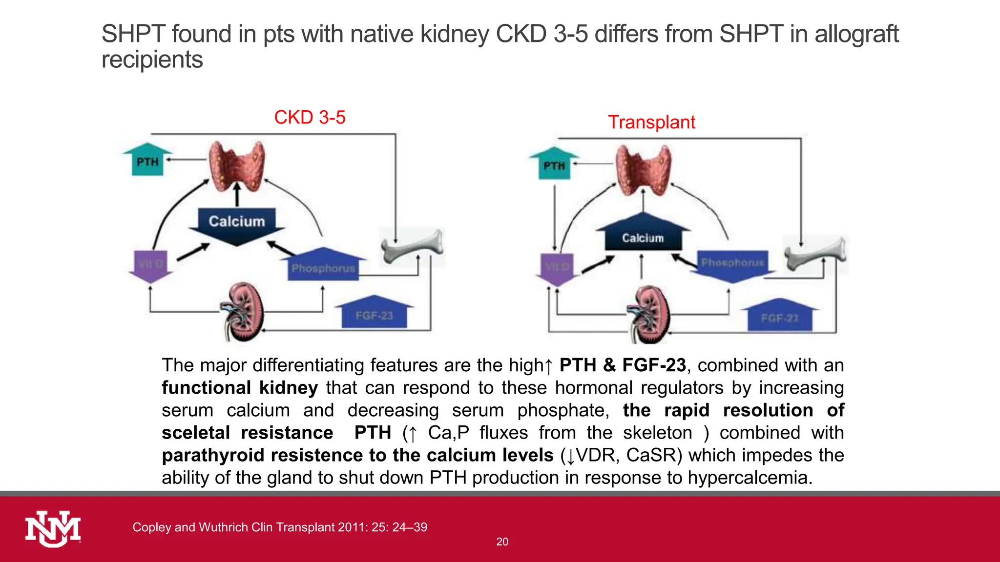 Management of SHPT in dialysis and beyond.pptx