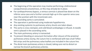 Management of Single Ventricle and evolution of Fontan surgery.pptx