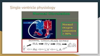 Management of Single Ventricle and evolution of Fontan surgery.pptx