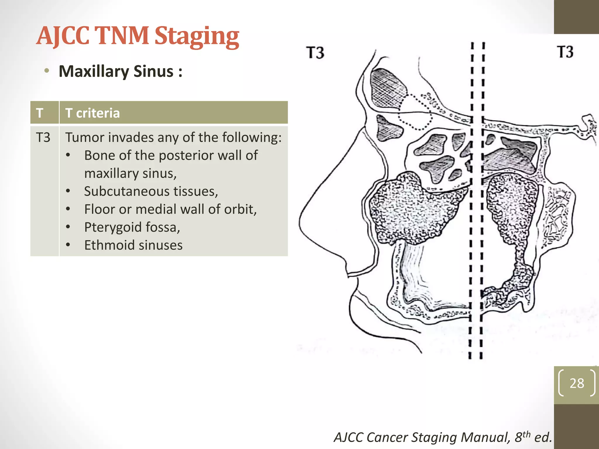 Management of sinonasal tract tumors 27082018 | PPTX