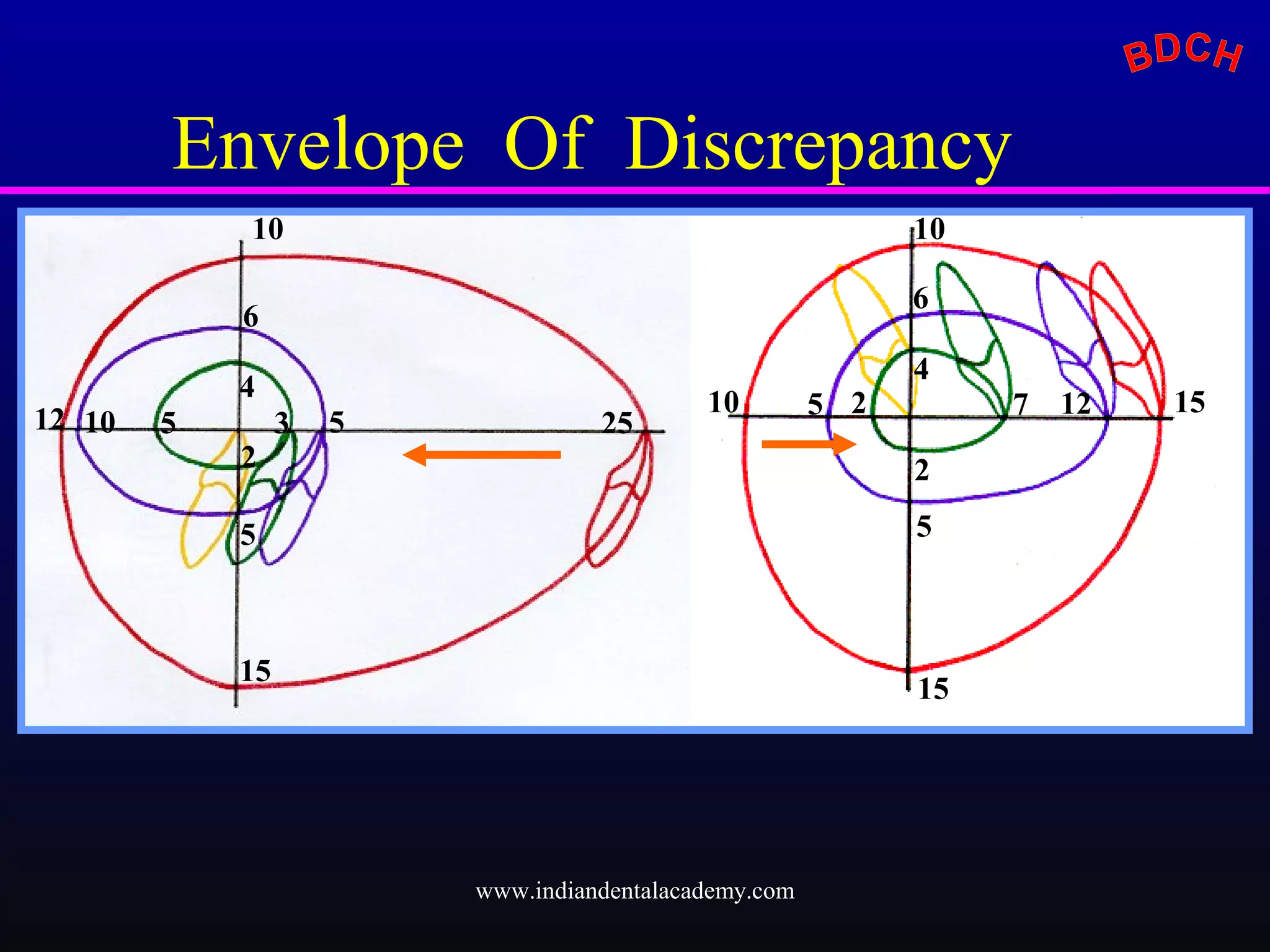 Management of skeletal discrepancies | PPT