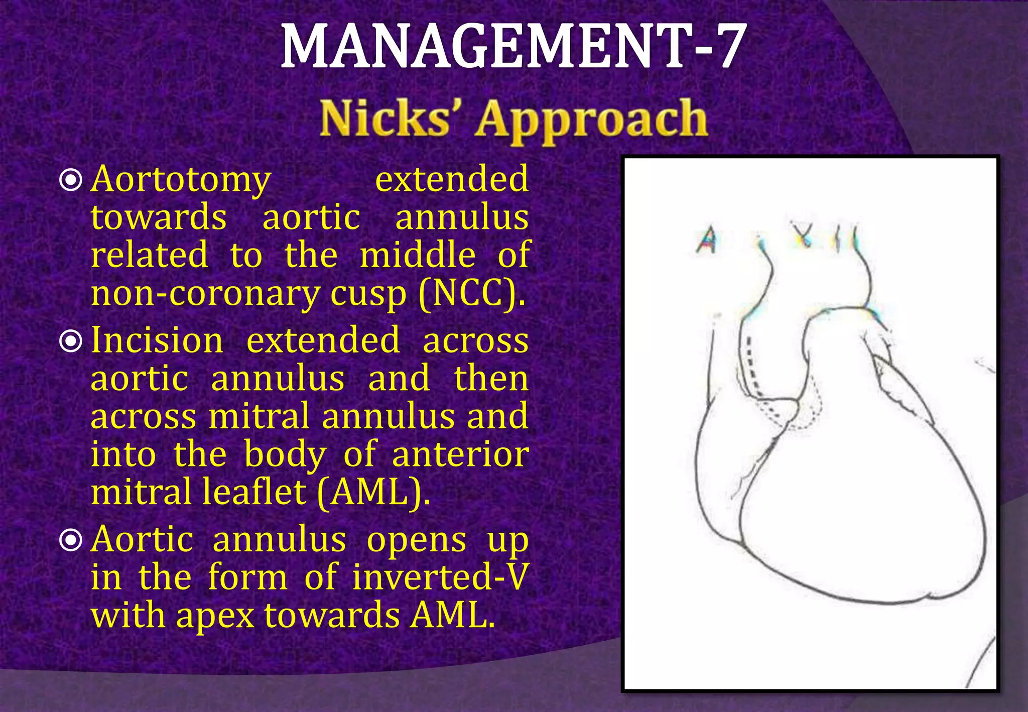 Management of Small Aortic Root | PPTX