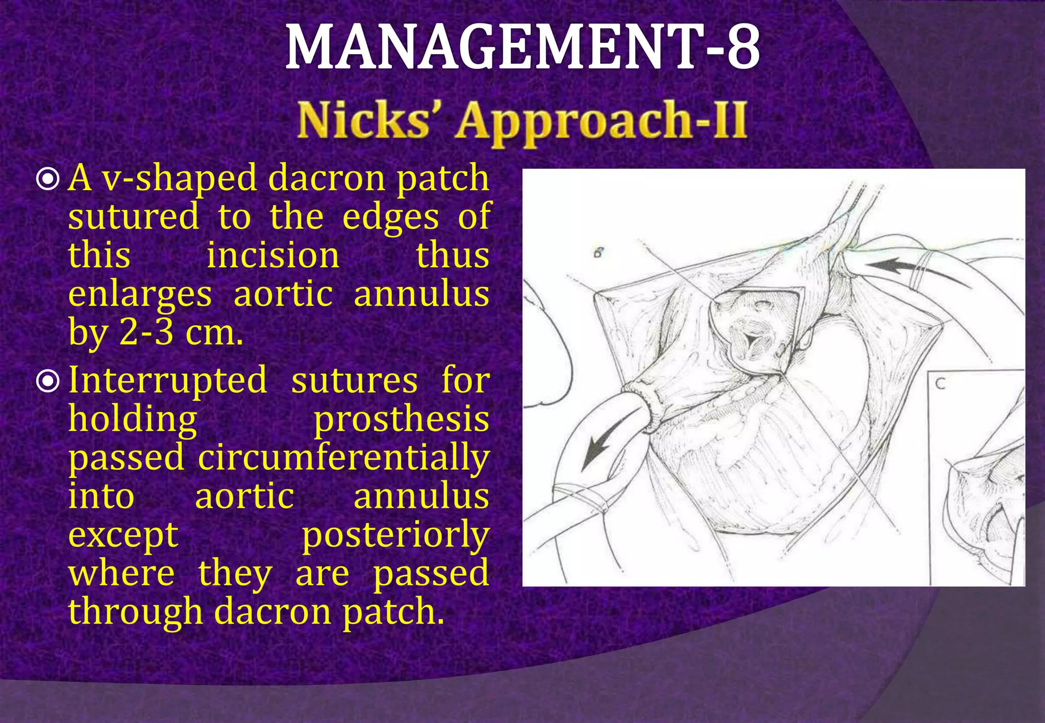 Management of Small Aortic Root | PPTX