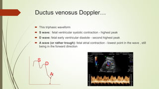 Management of small for gestational age fetus | PPTX