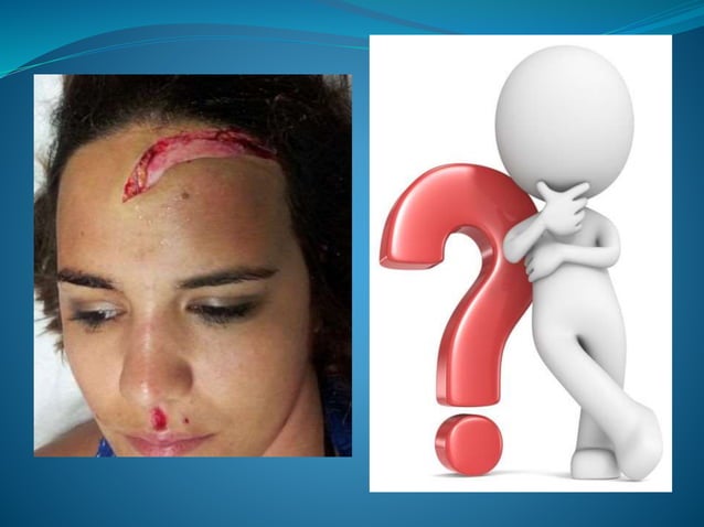 Management of soft tissue injuries in facial trauma | PPTX