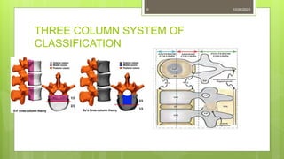 Management of spinal cord injury.pptx