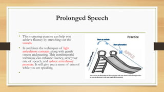 MANAGEMENT OF STAMMERING.pdf