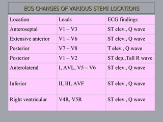 Management of stemi at emergency dept | PPT