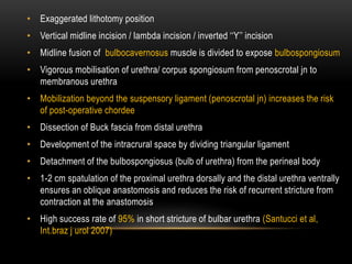Management of stricture urethra | PPTX
