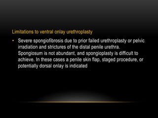 Management of stricture urethra | PPTX