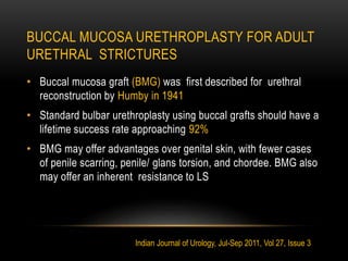 Management of stricture urethra | PPTX