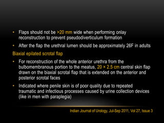 Management of stricture urethra | PPTX