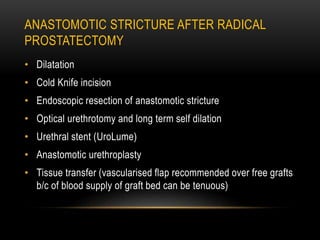Management of stricture urethra | PPTX