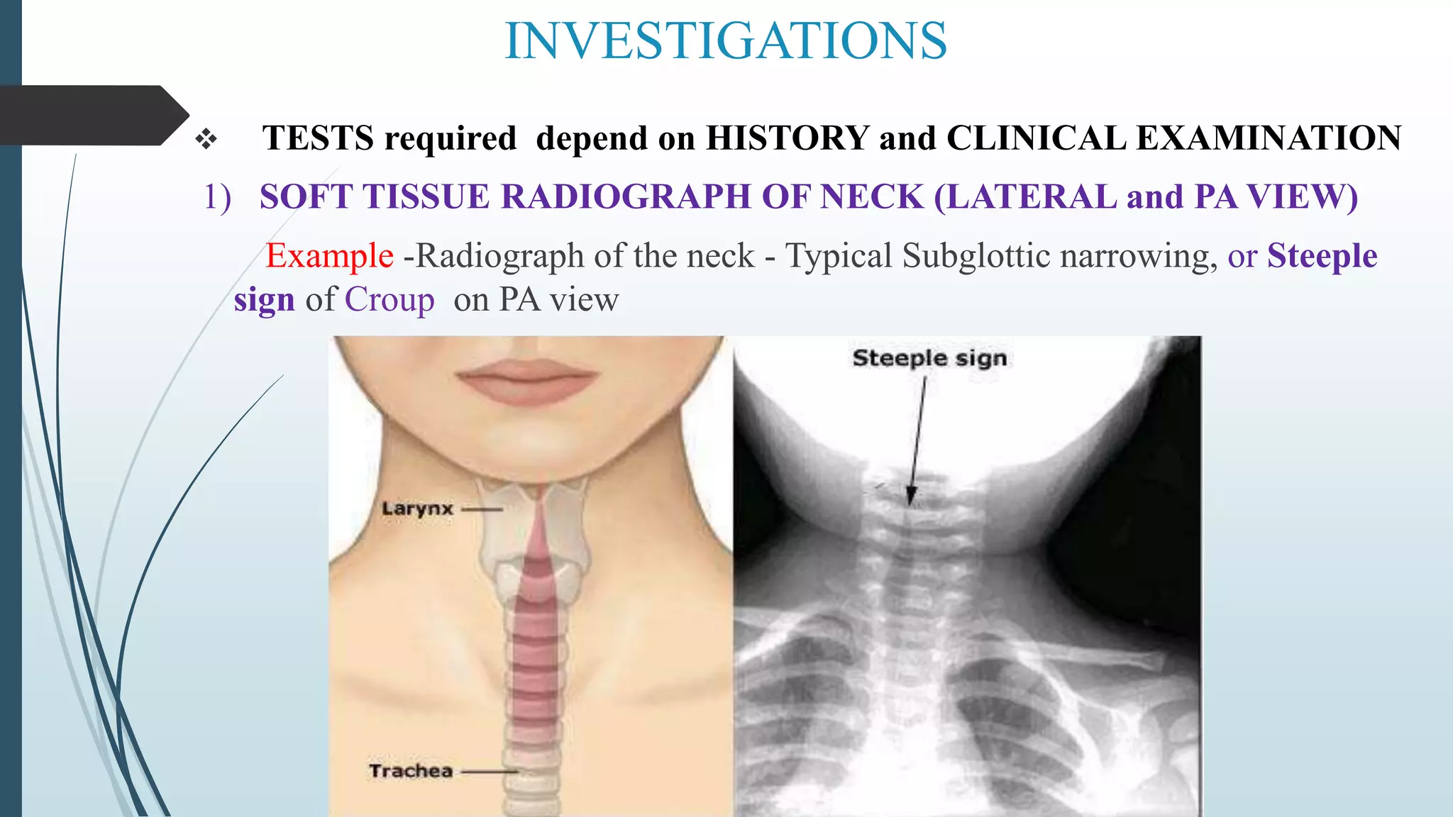 Management of stridor | PPTX