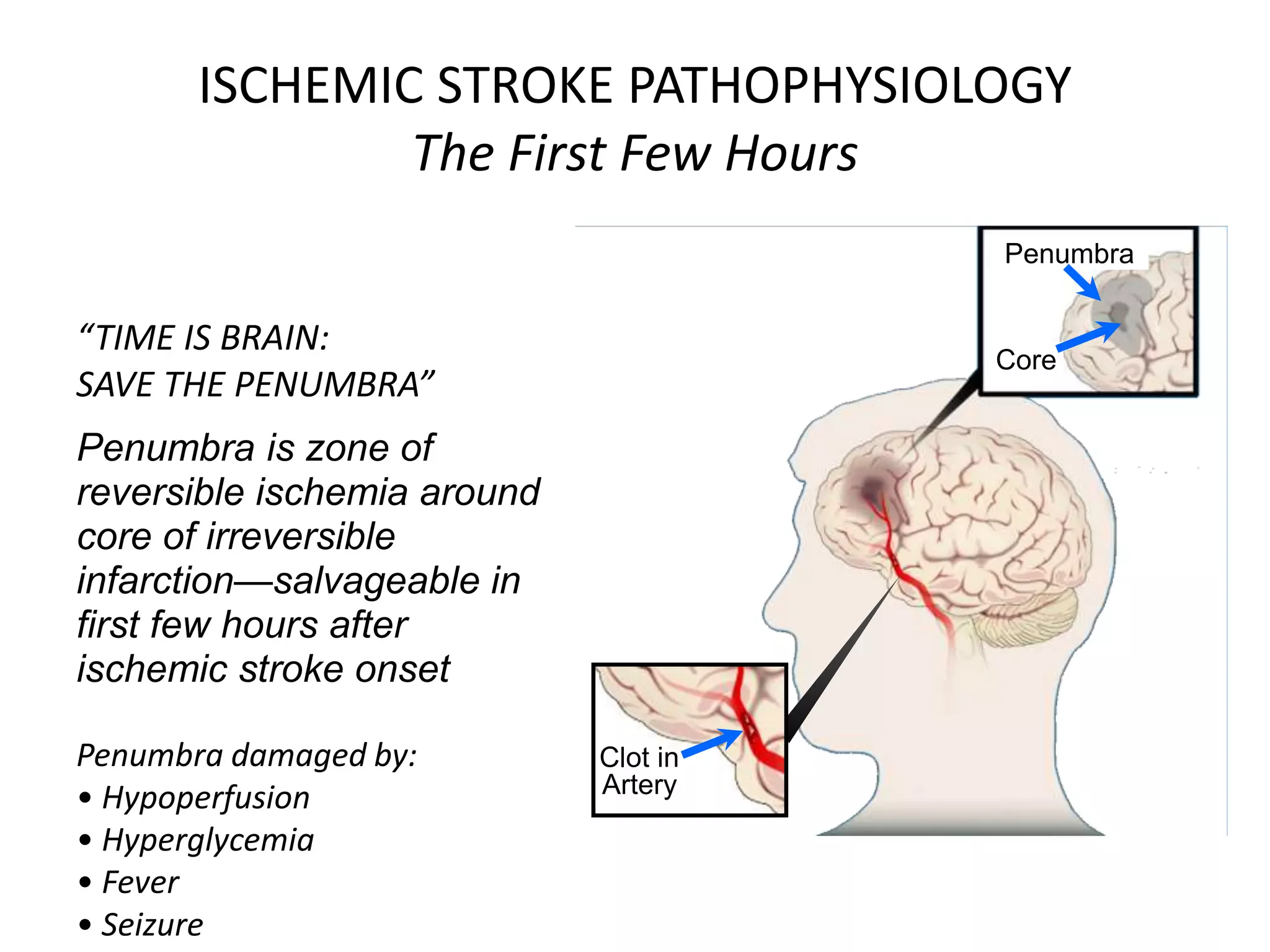 Management of stroke | PPTX