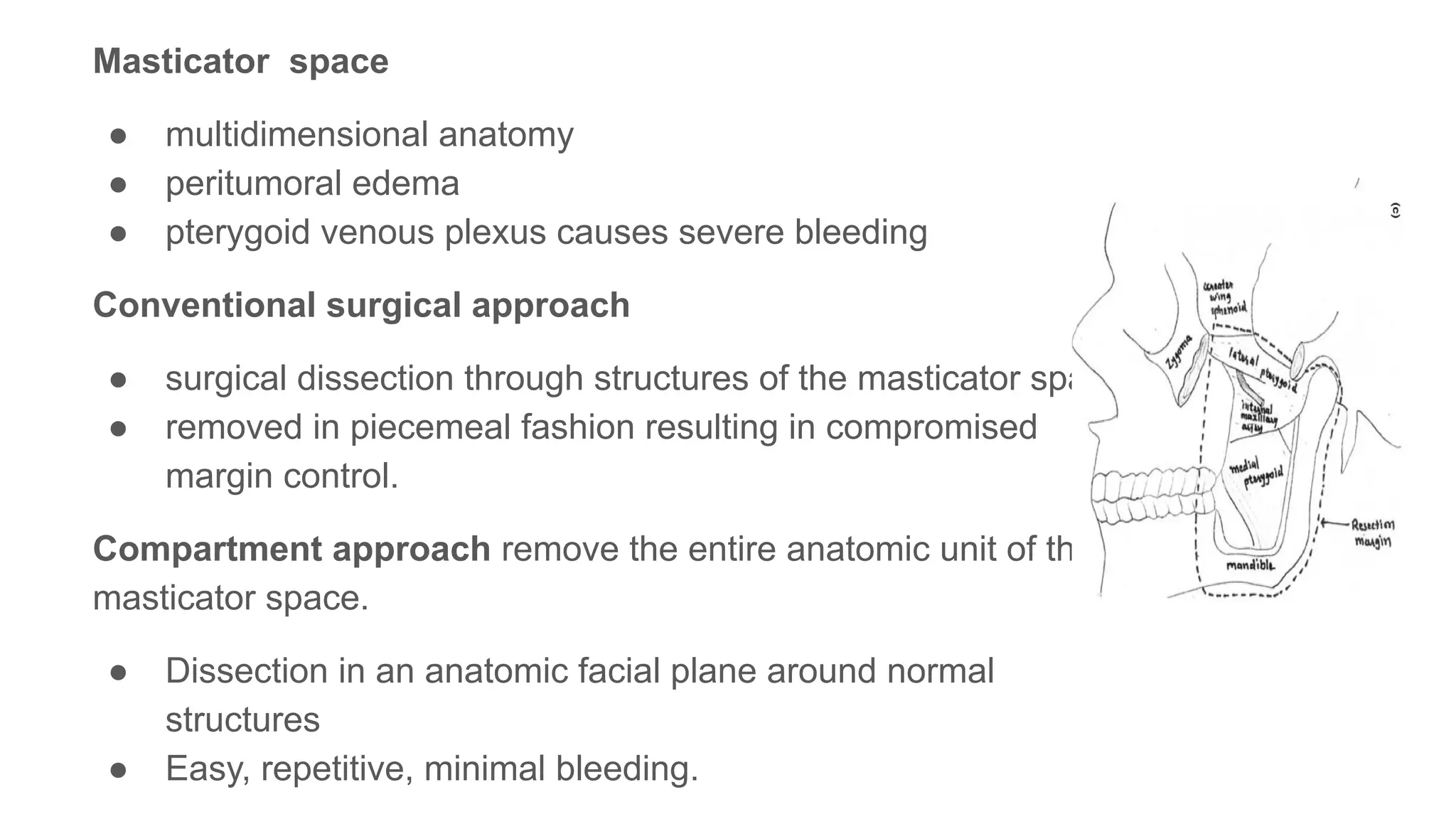 Management of supranotch disease by Dr Ankit Vishwani MCh head and neck ...