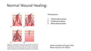 Management of surgical wound | PPTX