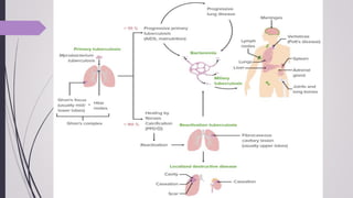 Management of TB.pptx