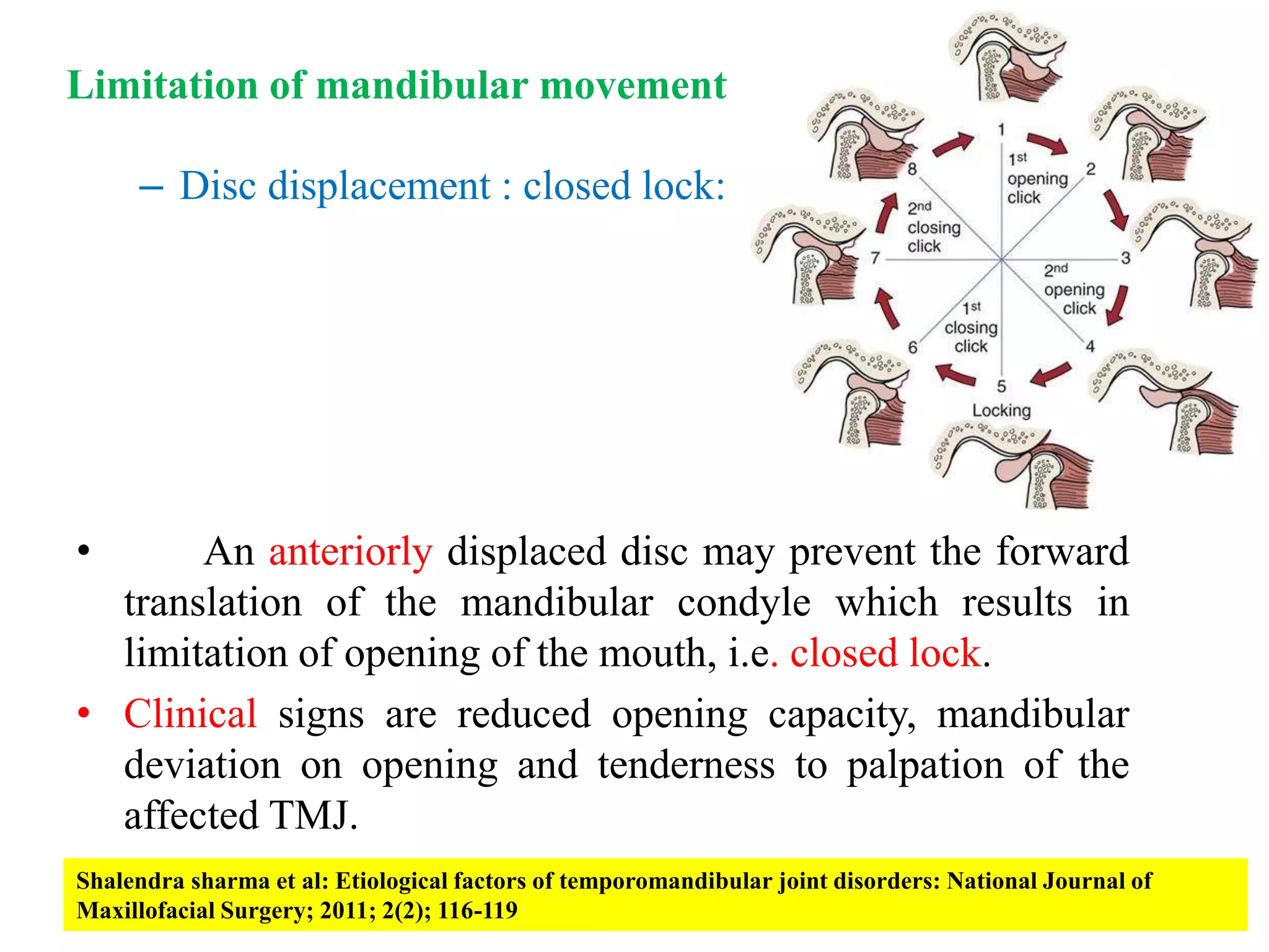 Management of temporomandibular disorders | PPTX