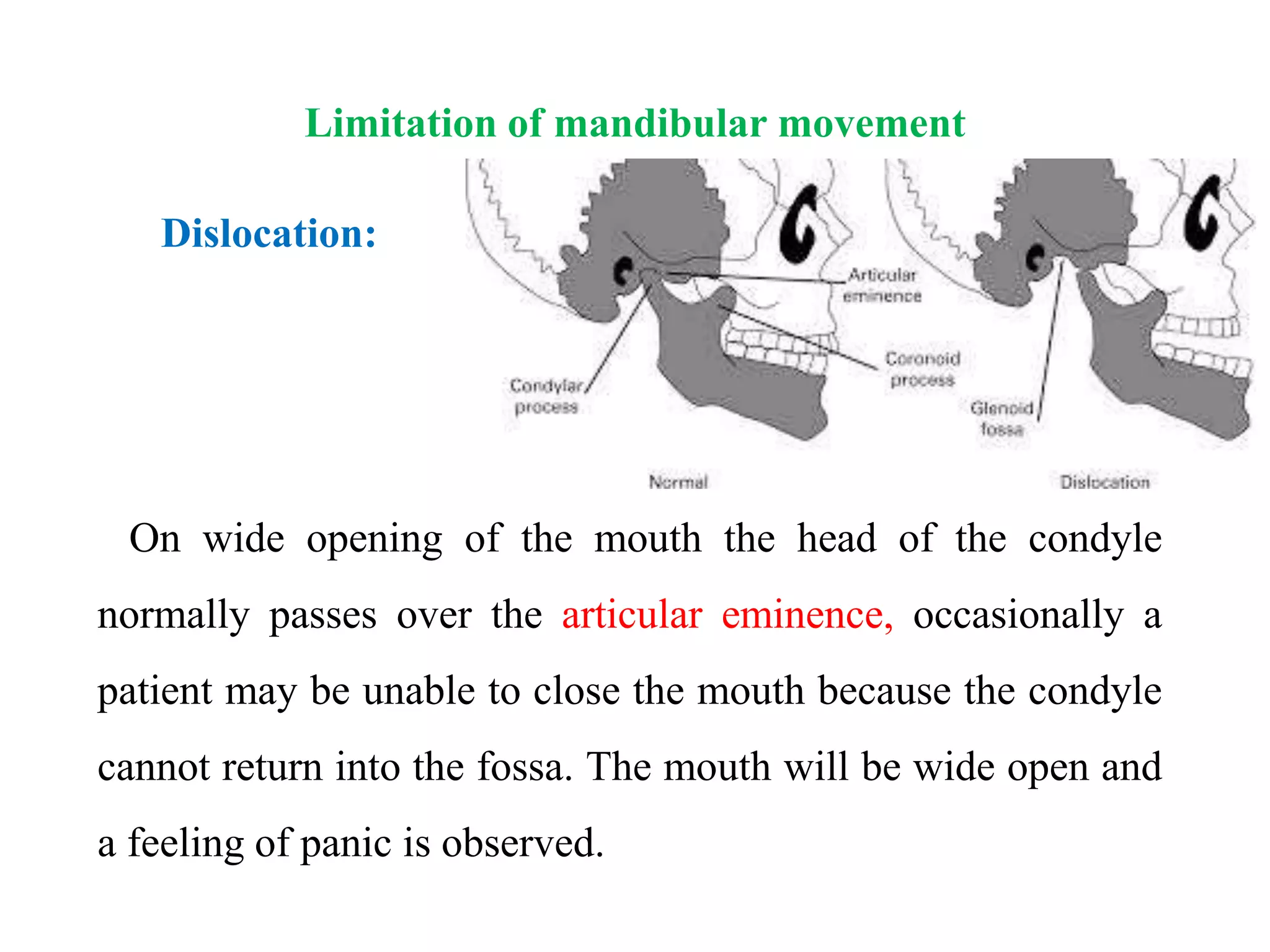 Management of temporomandibular disorders | PPTX