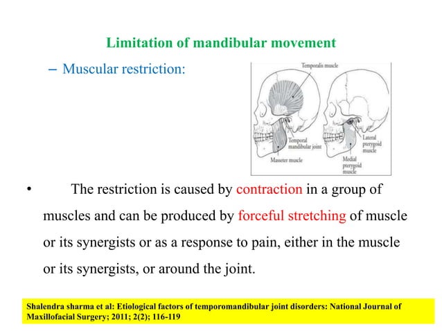 Management of temporomandibular disorders | PPTX