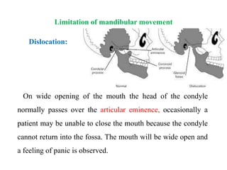 Management of temporomandibular disorders | PPTX