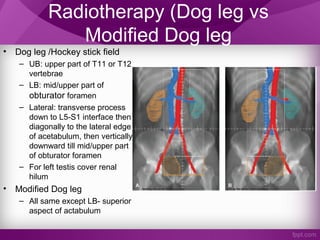 Management of testicular cancers | PPT