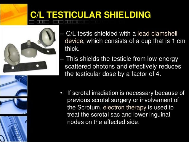 Management of testicular tumors-Seminoma (by Dr. Akhil Kapoor)