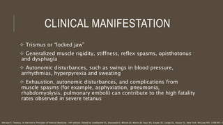 Management of Tetanus | PPTX