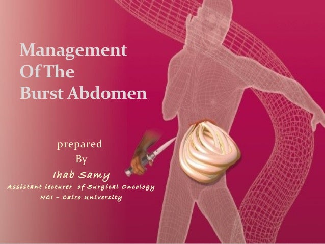 Management of the burst abdomen.ppt