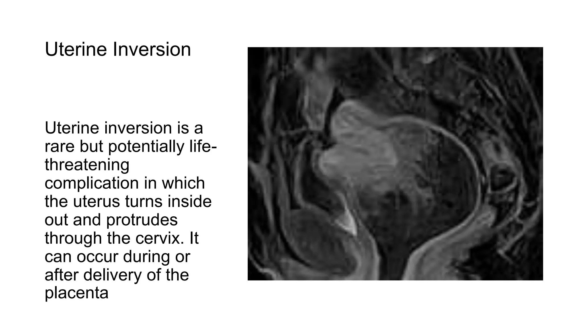 Management of the complications of second and third stages of labour ...