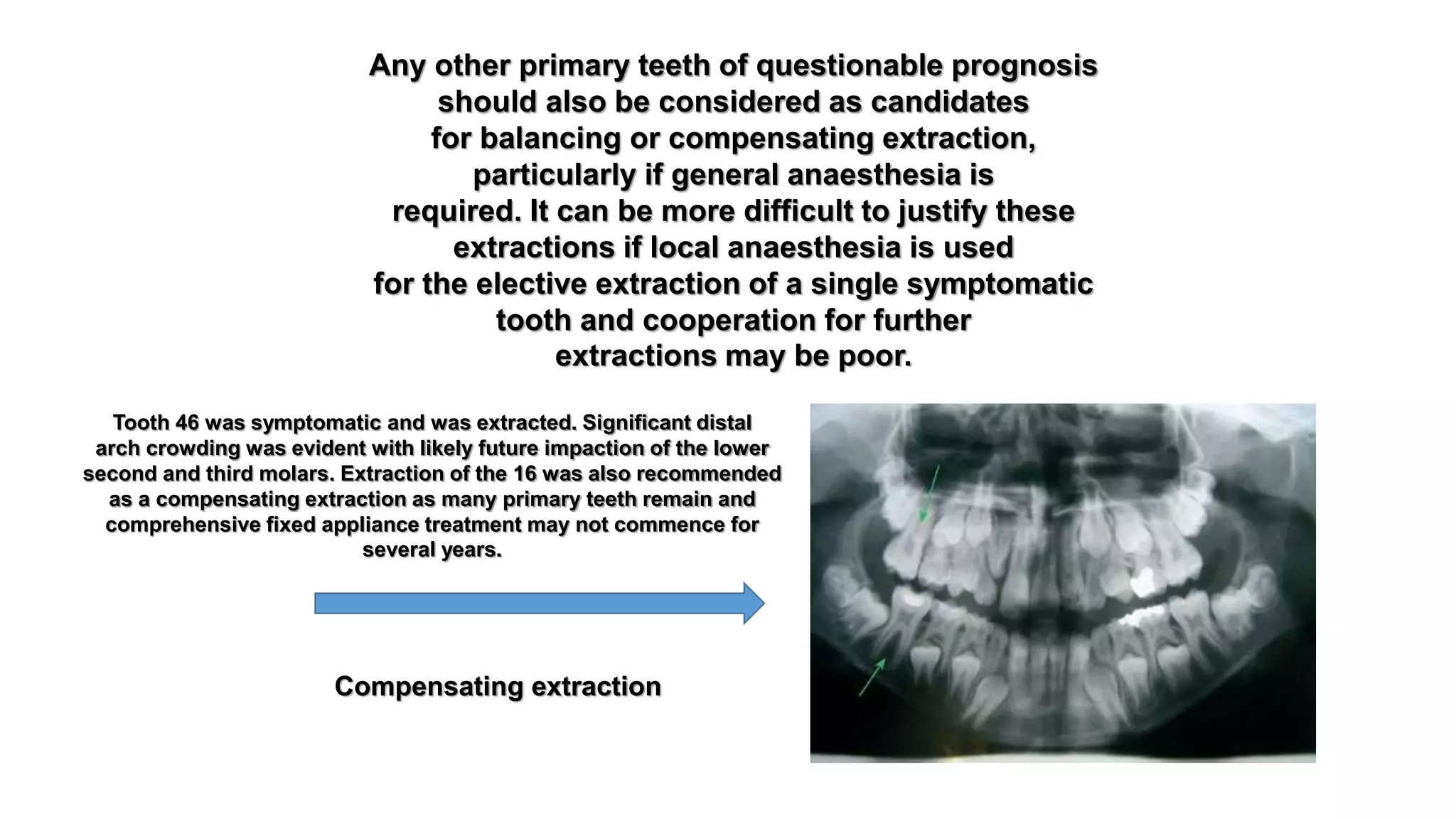 Management of the developing dentition 1 | PPTX