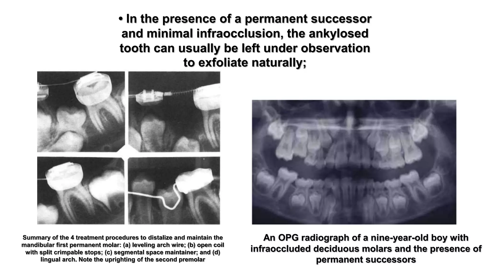 Management of the developing dentition 1 | PPTX