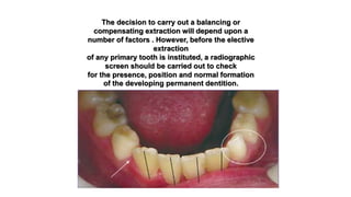 Management of the developing dentition 1 | PPTX