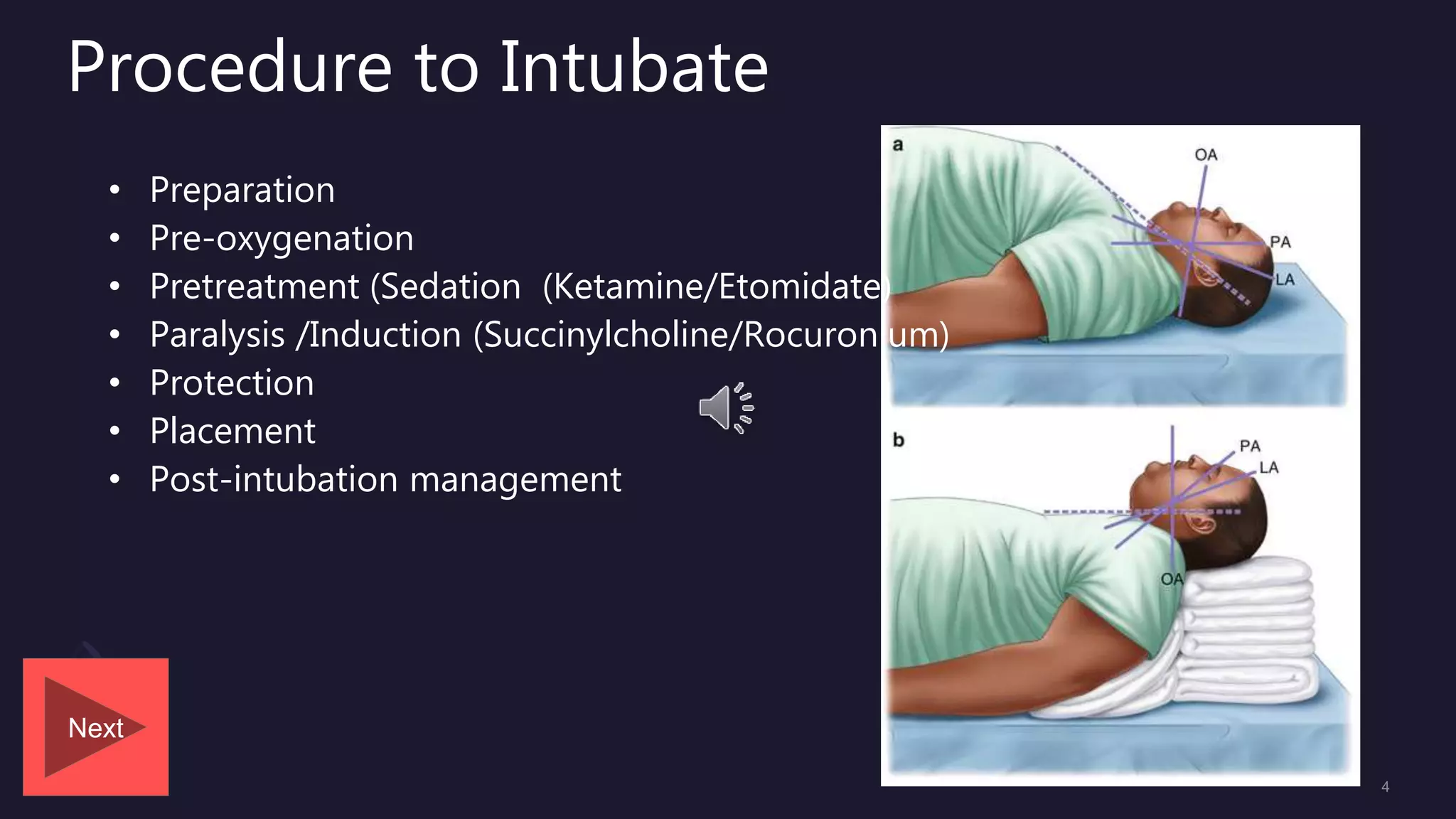 Management of the Difficult Airway.pptx
