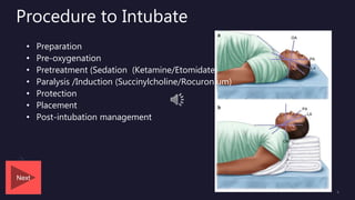 Management of the Difficult Airway.pptx