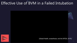 Management of the Difficult Airway.pptx