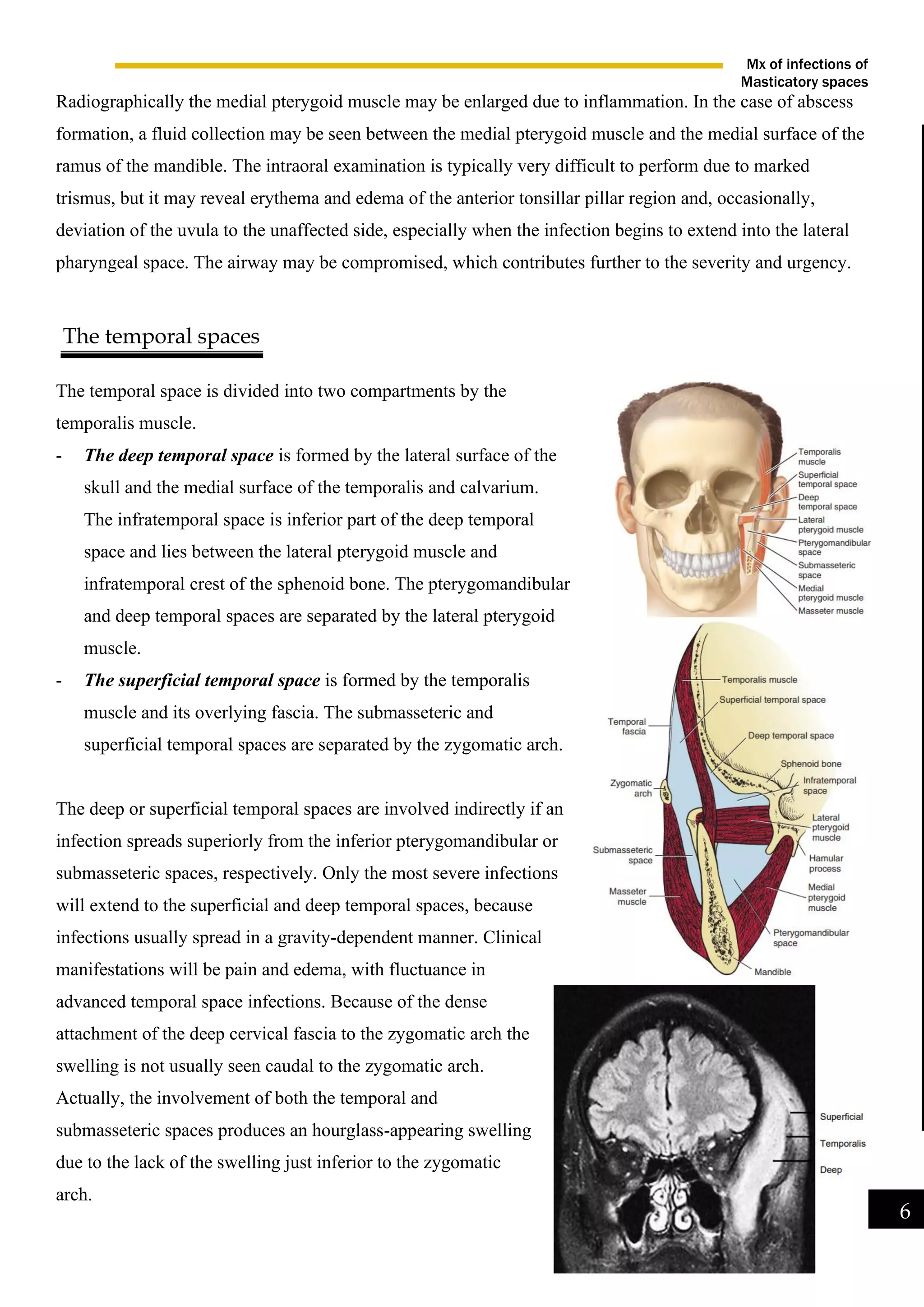 Management of the infections of the masticatory spaces | PDF