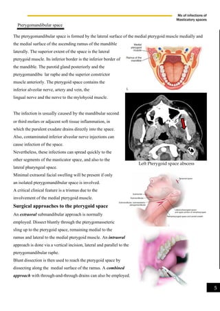 Management of the infections of the masticatory spaces | PDF