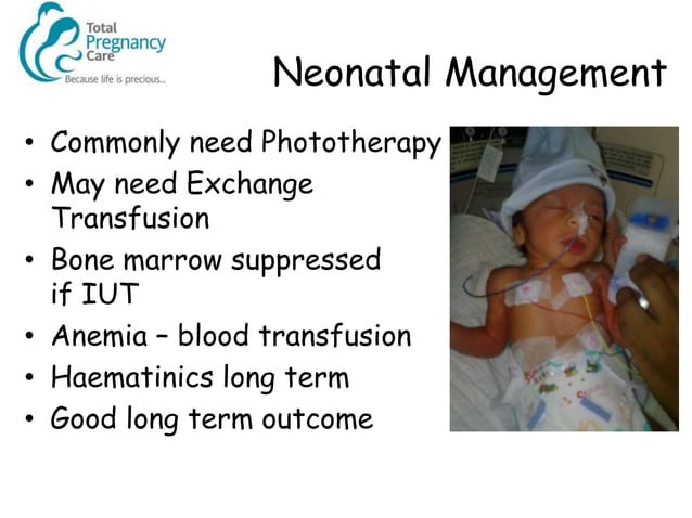 Management of the Rhesus Negative Mother | PPTX | Pregnancy ...