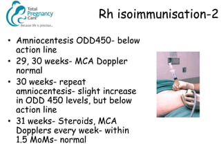 Management of the Rhesus Negative Mother | PPTX