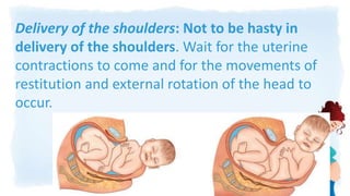 Management of the second stage of labour | PPTX