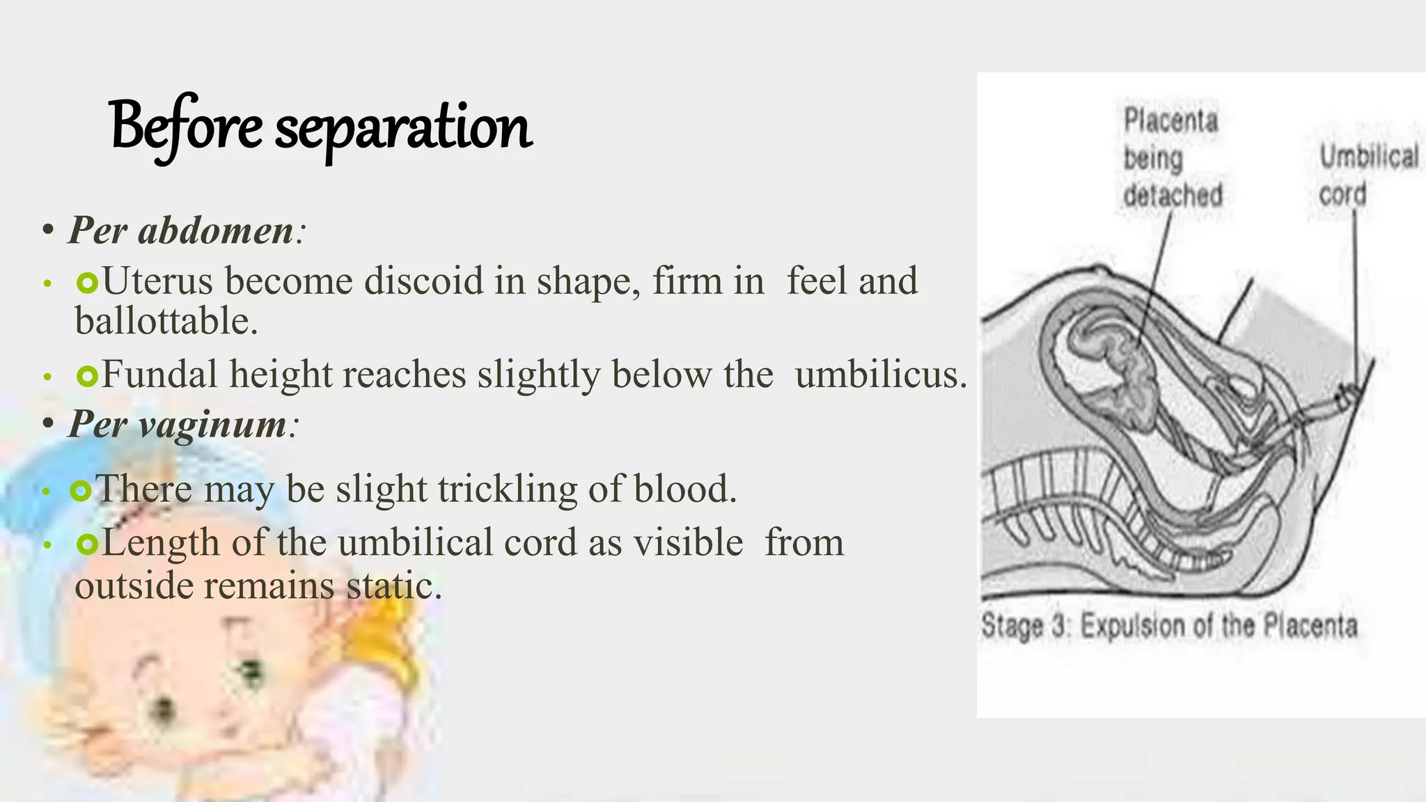 Management of third stage of labour | PPTX