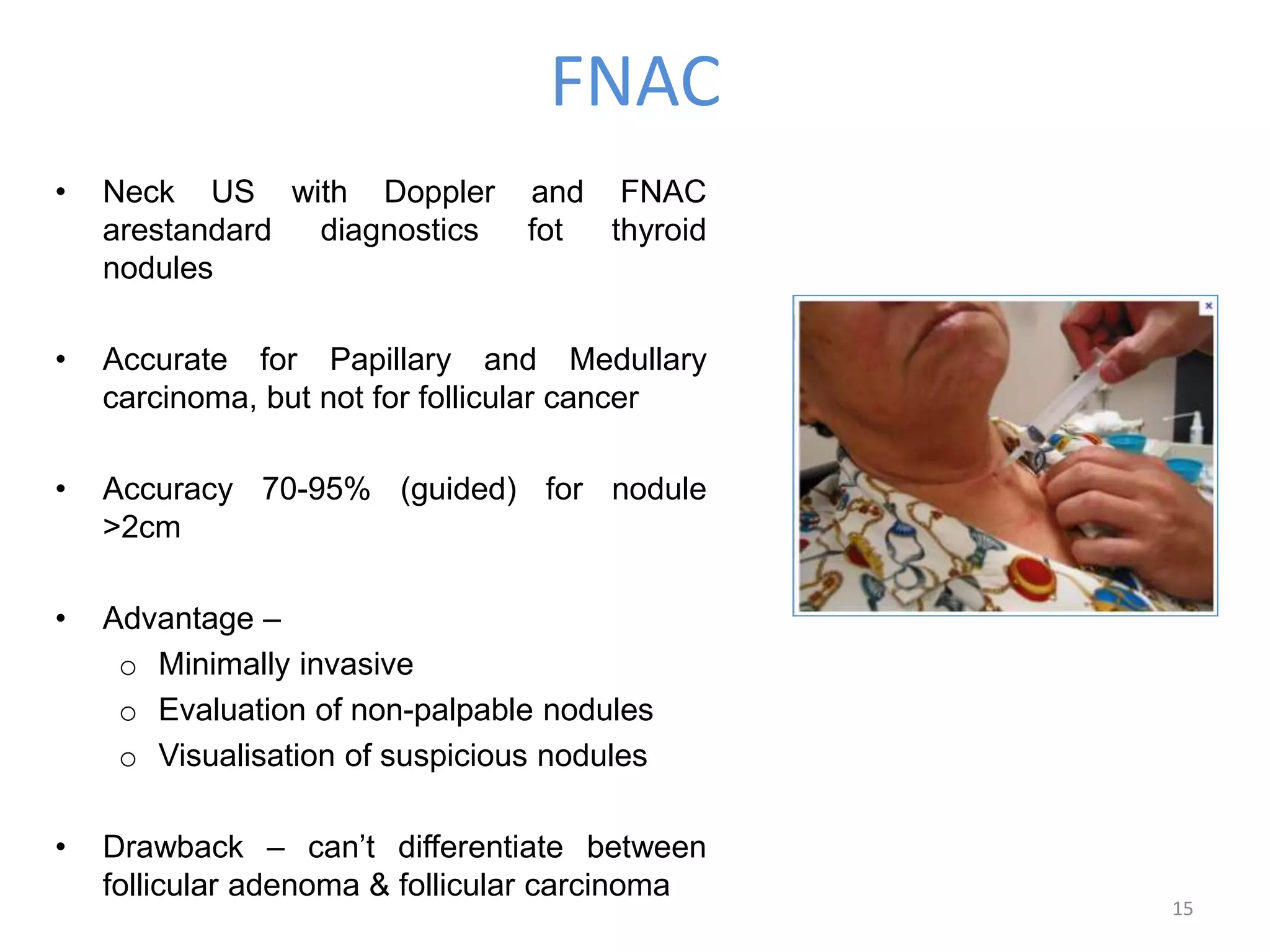 Management of thyroid cancer | PPTX