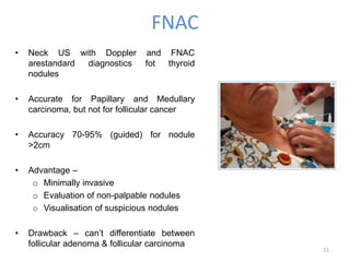 Management of thyroid cancer | PPTX